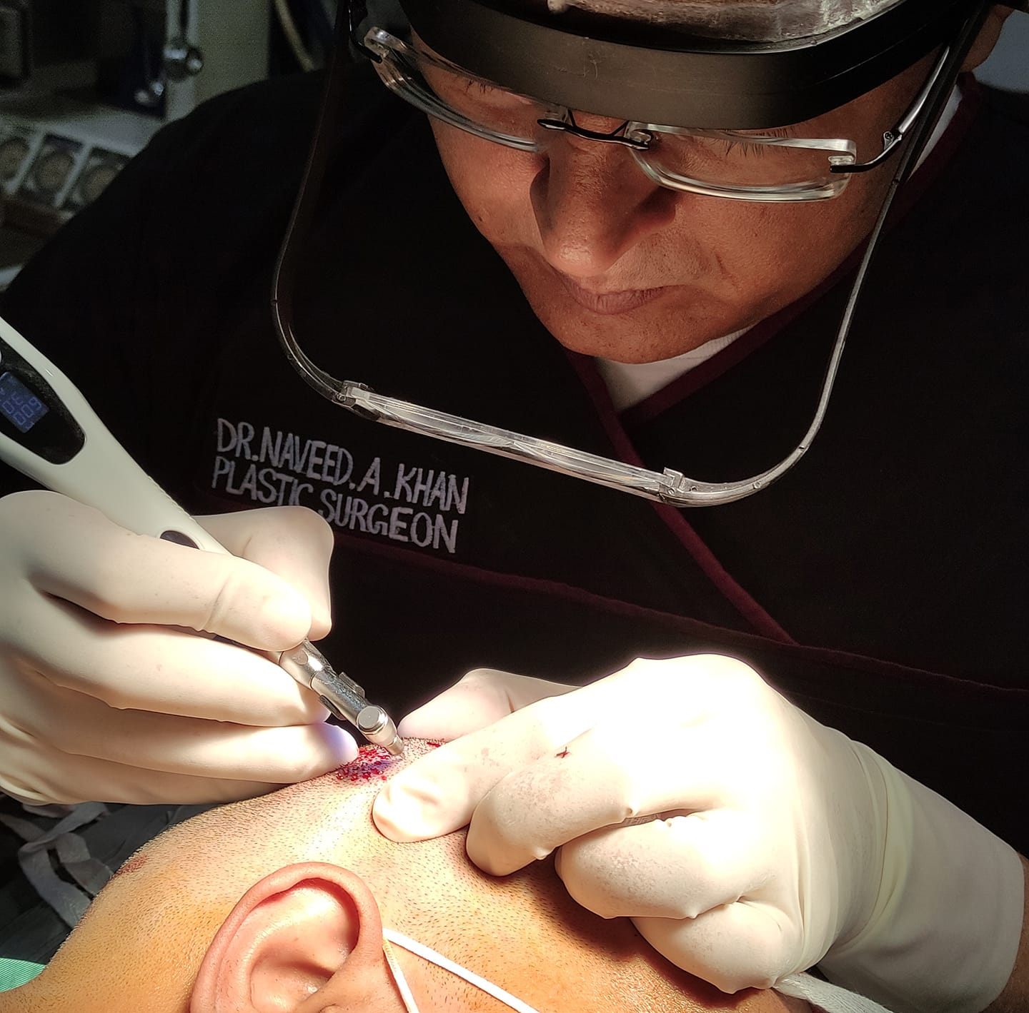 The different types of hand Plastic and Reconstructive surgery and ...